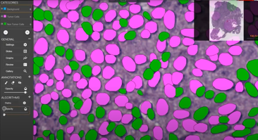 DeePathology AI solution for Cell Detection - Deepathology