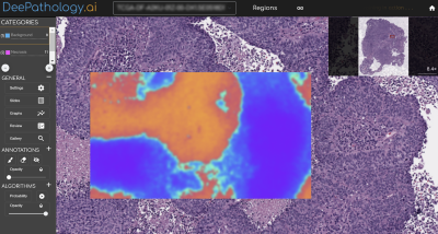 Heat Maps with DeePathology STUDIO in 5 minutes - Deepathology