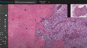 Foundation Models for Segmentation in Pathology! - Deepathology