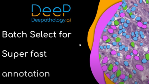 Batch Select for Super-fast Annotation - Deepathology