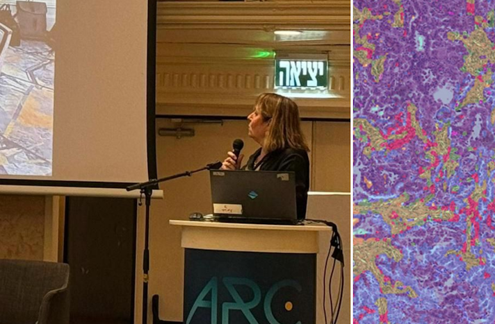 DeePathology introduces Segmentation by Factorization, an innovative ...